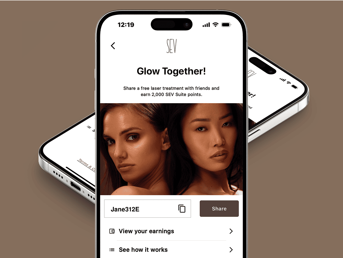 SEV Suite Reward Program | SEV Laser